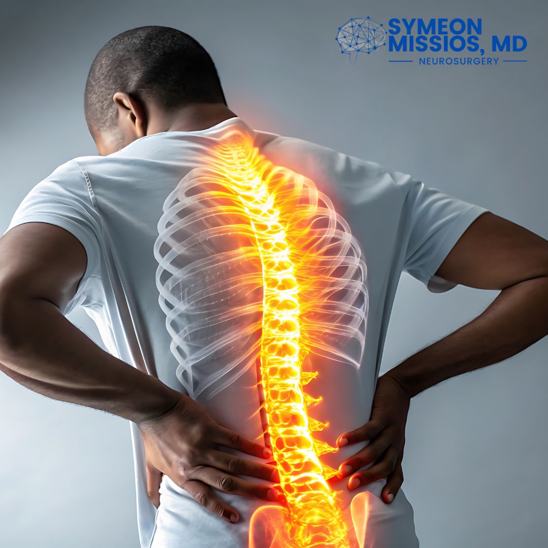 When To See A Surgeon For Back Pain | Dr. Symeon Missios, MD