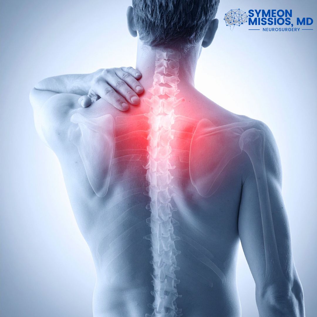 Back Pain vs. Pinched Nerve: Symptoms, Tests & When to Worry